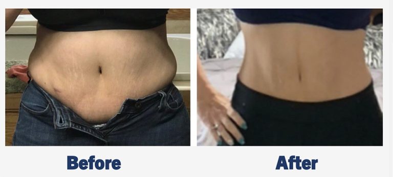 Red Light Therapy in Woodbury MN - Aspire Integrated Health